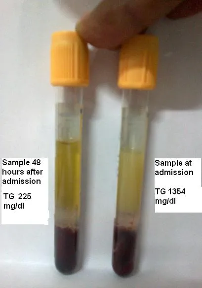 A preanalytical problem or something more? | myadlm.org