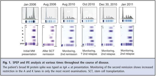 A 71 Year Old Woman with Multiple Myeloma Status after Stem Cell ...