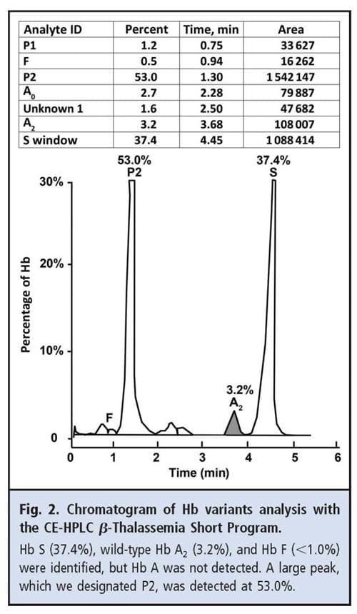 Unexpected Hemoglobin A1c Results | myadlm.org