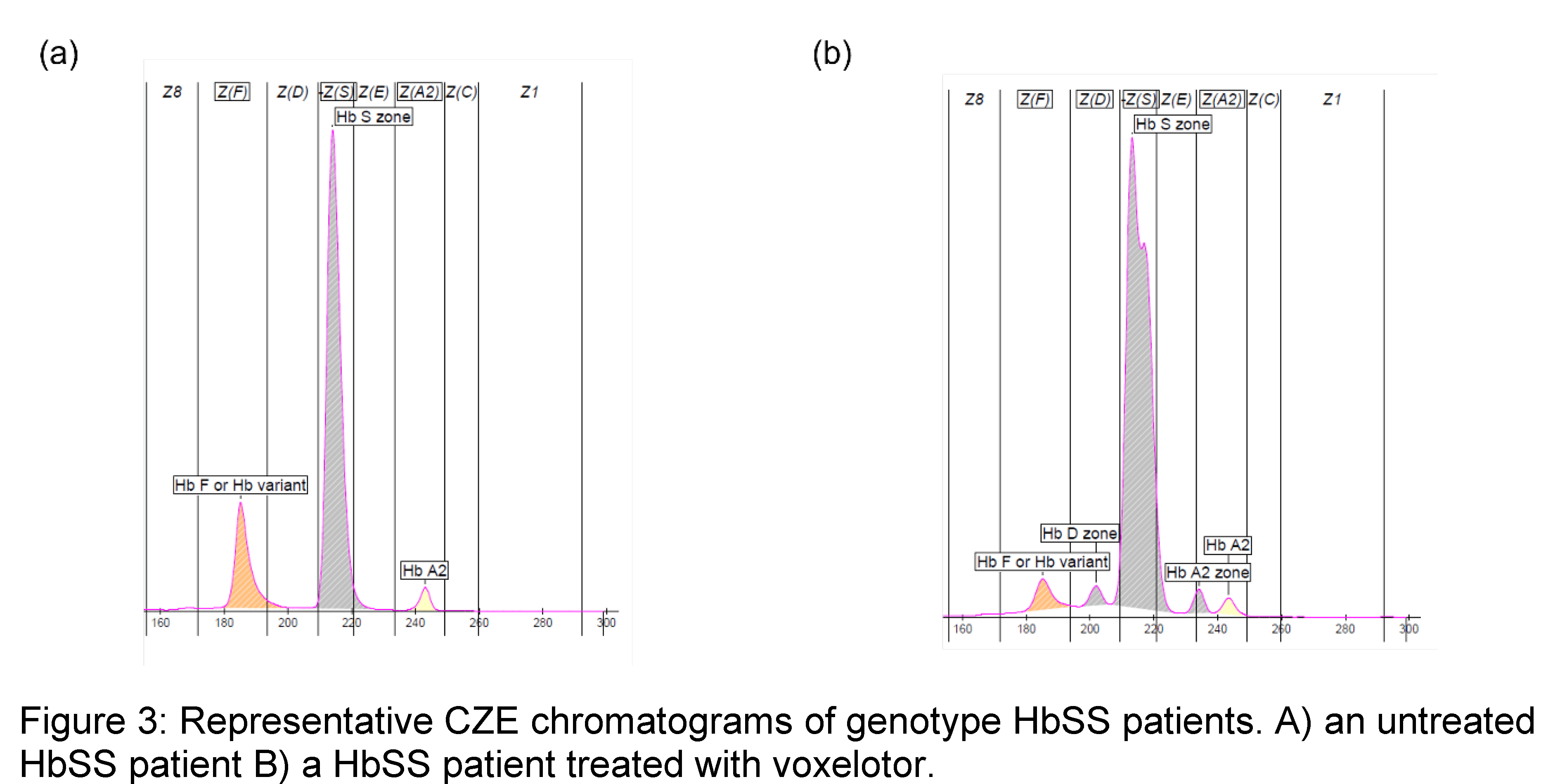 Managing Sickle Cell Disease | myadlm.org