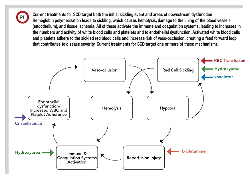 Managing Sickle Cell Disease | myadlm.org