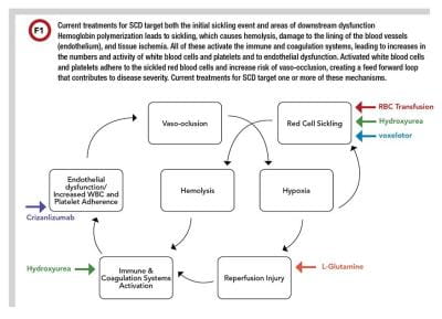 Managing Sickle Cell Disease | myadlm.org