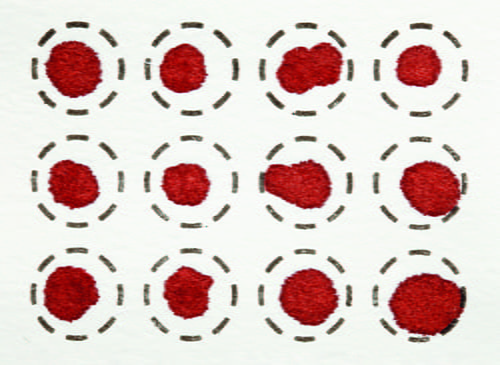 Dried Blood Spots and Beyond | myadlm.org