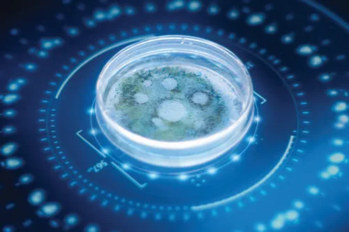 Understanding Laboratory Automation in Clinical Microbiology | myadlm.org