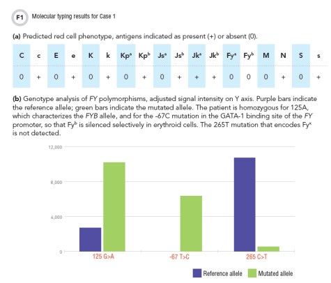 Molecular Typing for Red Blood Cell Antigens | myadlm.org